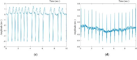 figure 2 from p wave detection using a fully convolutional neural