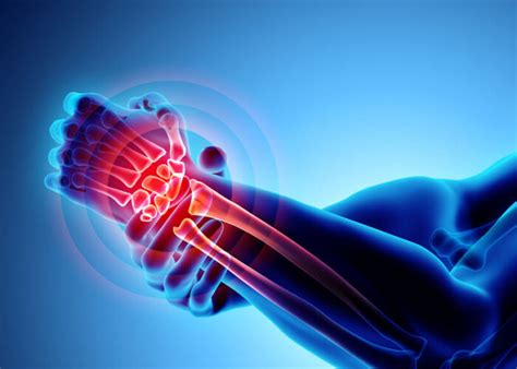 Wrist Pain First Contact Health