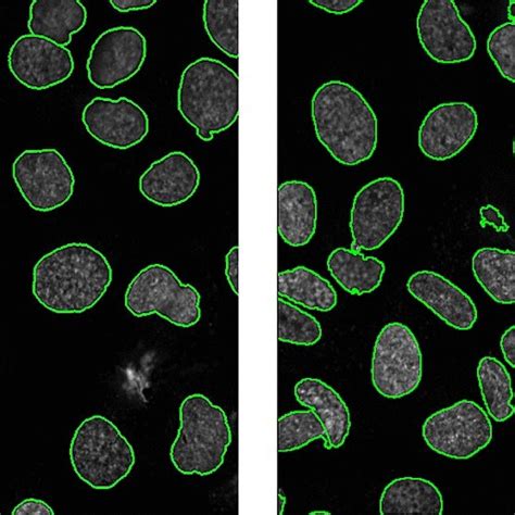 Ground Truth Of A U20s Cell Image Left And Cell Splitting Results Of