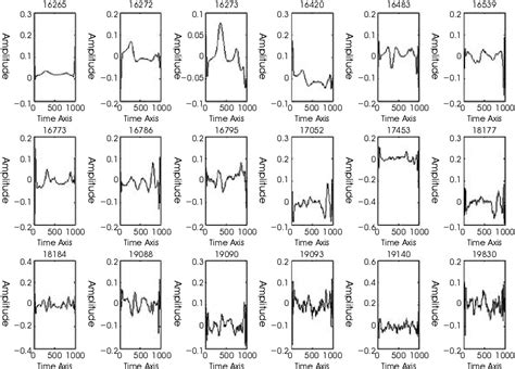 Figure 1 From Development Of Electrocardiogram Identification Algorithm For A Biometric System