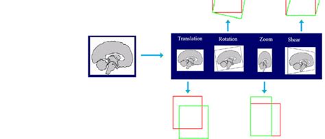 normalization step 12 parameters affine transformations download