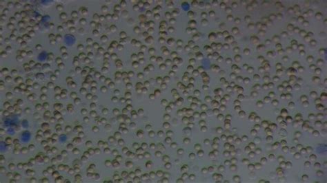 A Trypan Blue Live Rbcs Dead Cells Blue B Trypan Blue 200 X Download Scientific Diagram