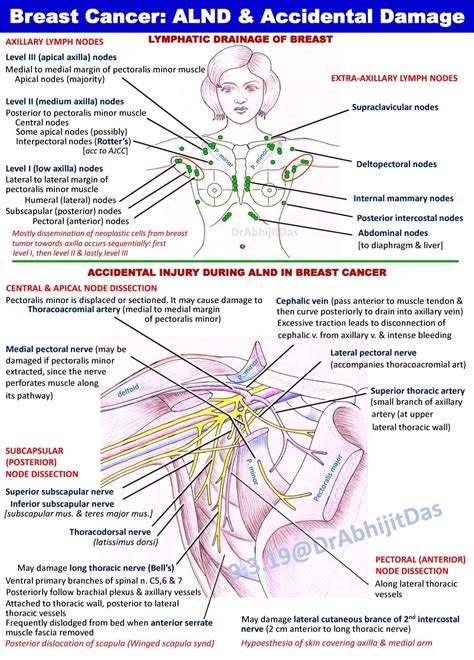 Dr Abhijitdas Make Surgipath Easy Lymphatic Drainage Of Breast