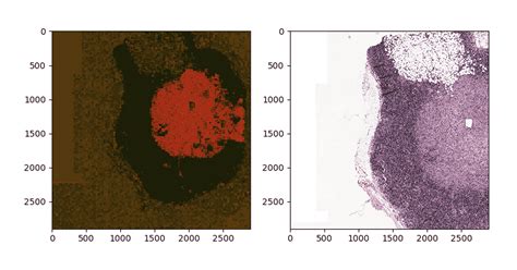 Automating Digital Pathology Image Analysis With Machine Learning