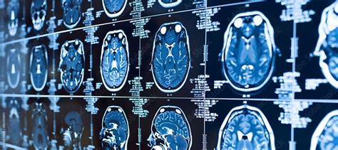 Ilustracja Stock Deep Learning Algorithm Interpreting Medical Images