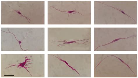 Examples Of Nine Different Pacemaker Cells Left And Middle Top