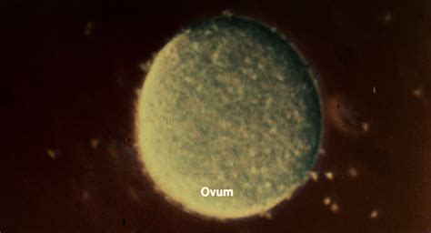 Taxxi Drivver 1976 Eporner