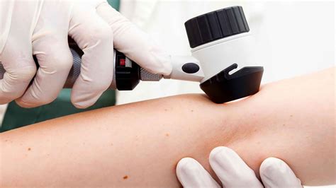 Systemic Sclerosis Skin Tests More Than Scleroderma