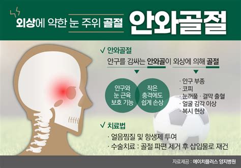 외상에 약한 눈 주위 골절 안와 골절의 모든 것