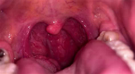 Asian Vore Japan Girl Uvula Ja 1