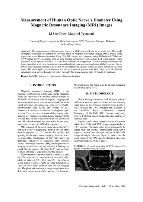 Pdf Measurement Of Human Optic Nerves Diameter Using Magnetic Resonance Imaging Mri Images