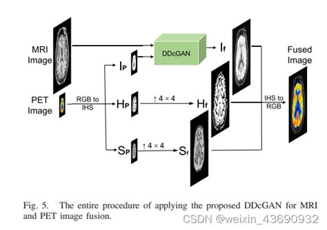 Ddcgan用于多分辨率图像融合的双判别器条件生成对抗网络a Dual Discriminator Conditional