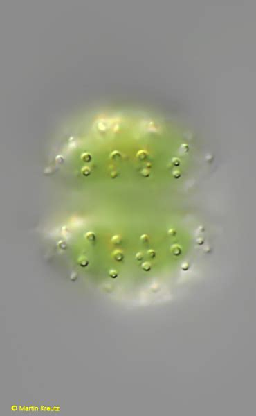 Actinosphaerium Eichhornii Real Micro Life