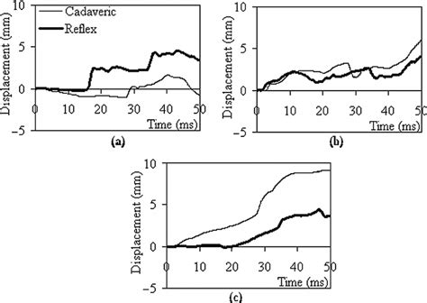 Comparison Of Relative Tibia Displacements Of The Impacted Leg I E Download Scientific