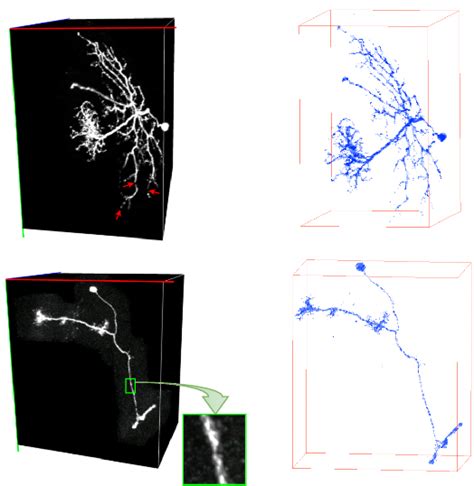 Figure 1 From Pointneuron 3d Neuron Reconstruction Via Geometry And Topology Learning Of Point