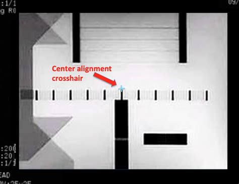 Slice Position And Accuracy Questions And Answers In Mri