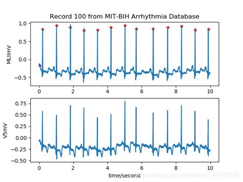 Python中的wfdb库使用python Wfdb Csdn博客