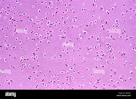 Klebsiella Pneumoniae Gram Stain Morphology