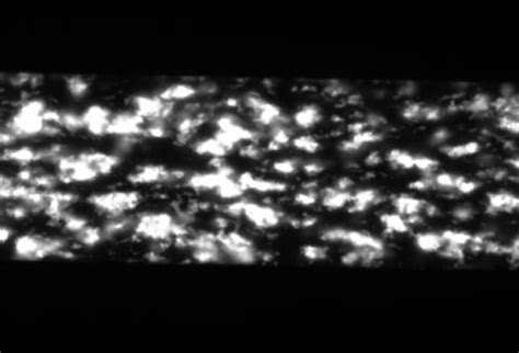 Calcein Labeled Platelet Aggregation On Collagen Cell Microsystems