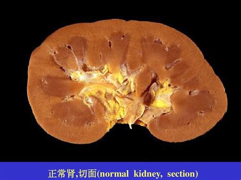 病理学实习镜下 泌尿系统 word文档在线阅读与下载 无忧文档