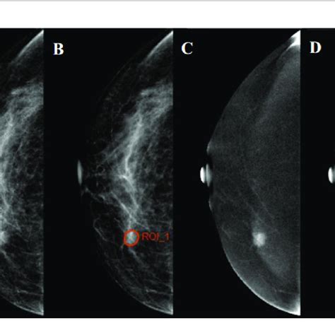 Examples Of Regions Of Interest Rois Segmentation On Download