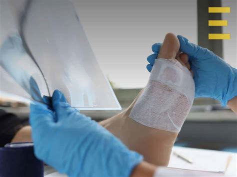 Can A Compression Fracture Heal On Its Own