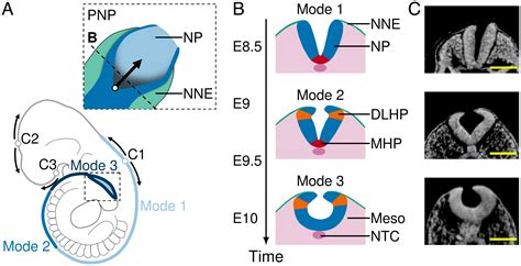 Secondary Neurulation