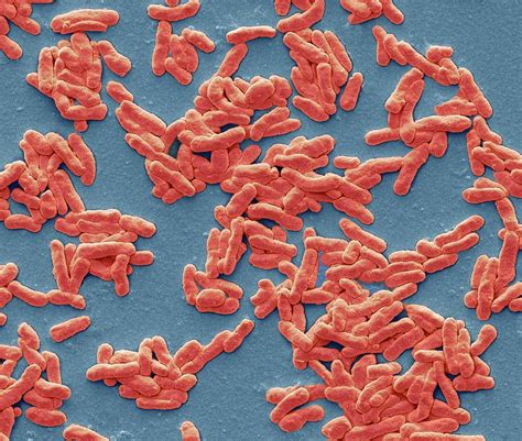 Mycobacterium Leprae 1 By Science Photo Library