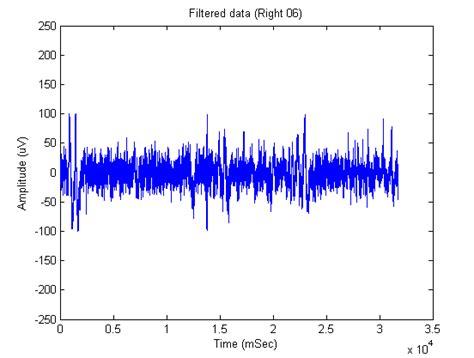 Raw EEG Data In Time Domain One Sample Download Scientific Diagram