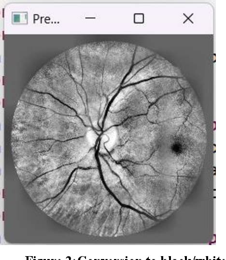 Figure 2 From Multi Modal Aiml Integration For Precision Glaucoma Detection A Comprehensive