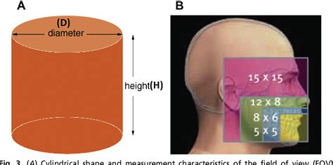 Figure 3 From Basic Principles Of Cone Beam Computed Tomography Semantic Scholar