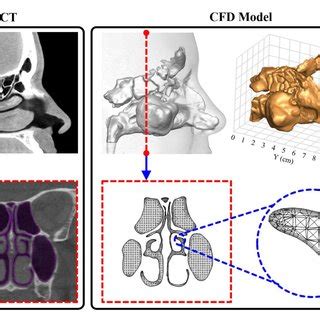 CT Based Computational Model Side By Side Comparison Of The CT Scan Download Scientific