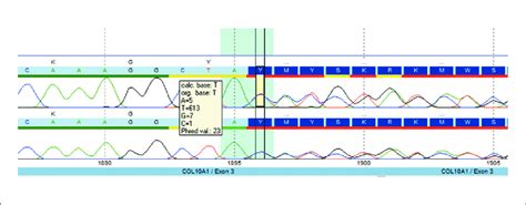 Dna Sequence Electropherogram Of The Col10a1 Gene Exon 3 Of The Download Scientific Diagram