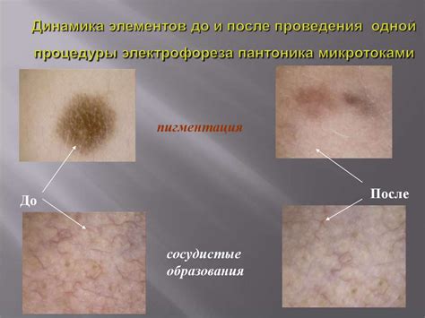 Возможности применения пантоника в физиотерапии презентация онлайн