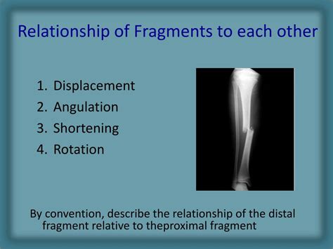 PPT Radiology Of Fracture Principles PowerPoint Presentation Free Download ID 1589986