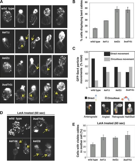 Defects In Actin Cable Morphology And Transport Of Secretory Vesicles