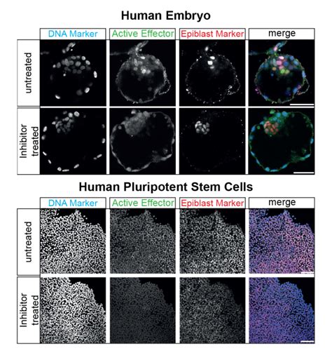 Human Epiblast Pluripotency Is Nodal Independent — Hdbi Human