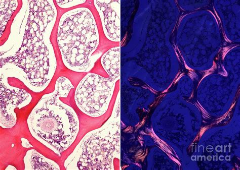 Spongy Bone Histology
