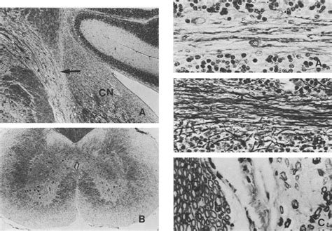 A Section Through Cerebellum And Medulla At The Level Of The Cochlear