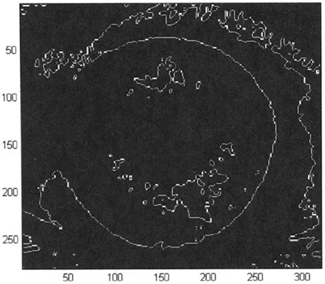 Edge Detection Using Sobel Filter Download Scientific Diagram