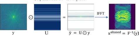 Figure 1 From De Aliasing And Accelerated Sparse Magnetic Resonance Image Reconstruction Using