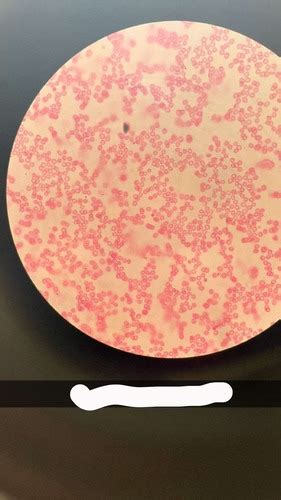 Lab Practical Slides Flashcards Quizlet