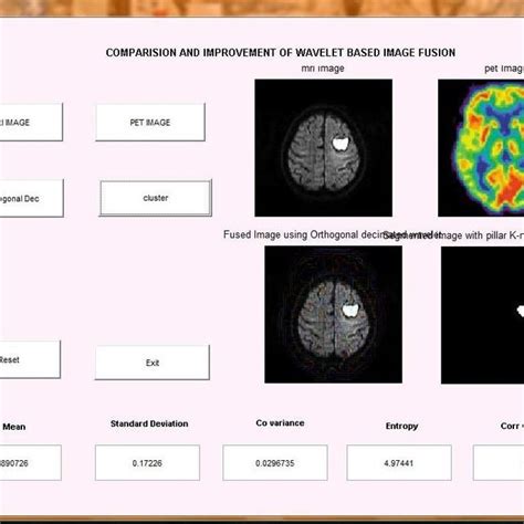 orthogonal wavelet fused image figure 5 pillar k means clustering