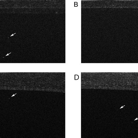 Examples Of SD OCT B Scan Image In An Inflamed Eye A Control Eye Download Scientific Diagram
