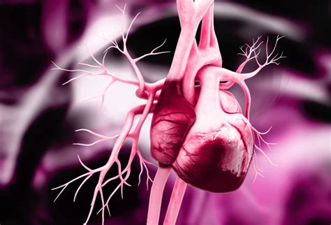 Vascul Aid Une étude Européenne Sur Lia Pour Prédire Laggravation