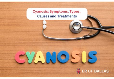 Cyanosis Symptoms Types Causes And Treatments Er Of Dallas Tx