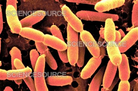 Lactobacillus Acidophilus Stock Image Science Source Images