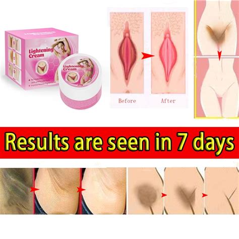 30g Whitening Cream Armpit Whitening Private Parts Underarm Bleaching Serum Whiten Butt Knee