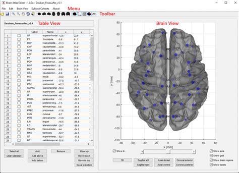 brain atlas braphbraph