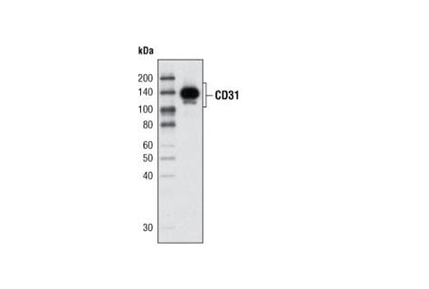 Cd31 Pecam 1 89c2 Mouse Mab Cst 优宁维 Univ 商城